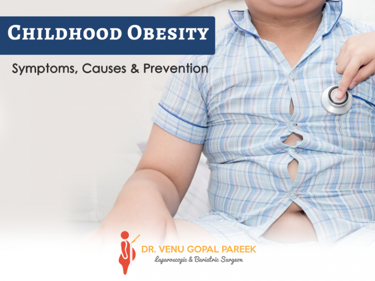 Childhood Obesity – Symptoms, Causes and Prevention - Bariatric Surgeon ...