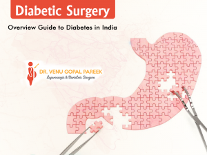 Diabetic surgery: Overview Guide to Diabetes in India - Bariatric ...