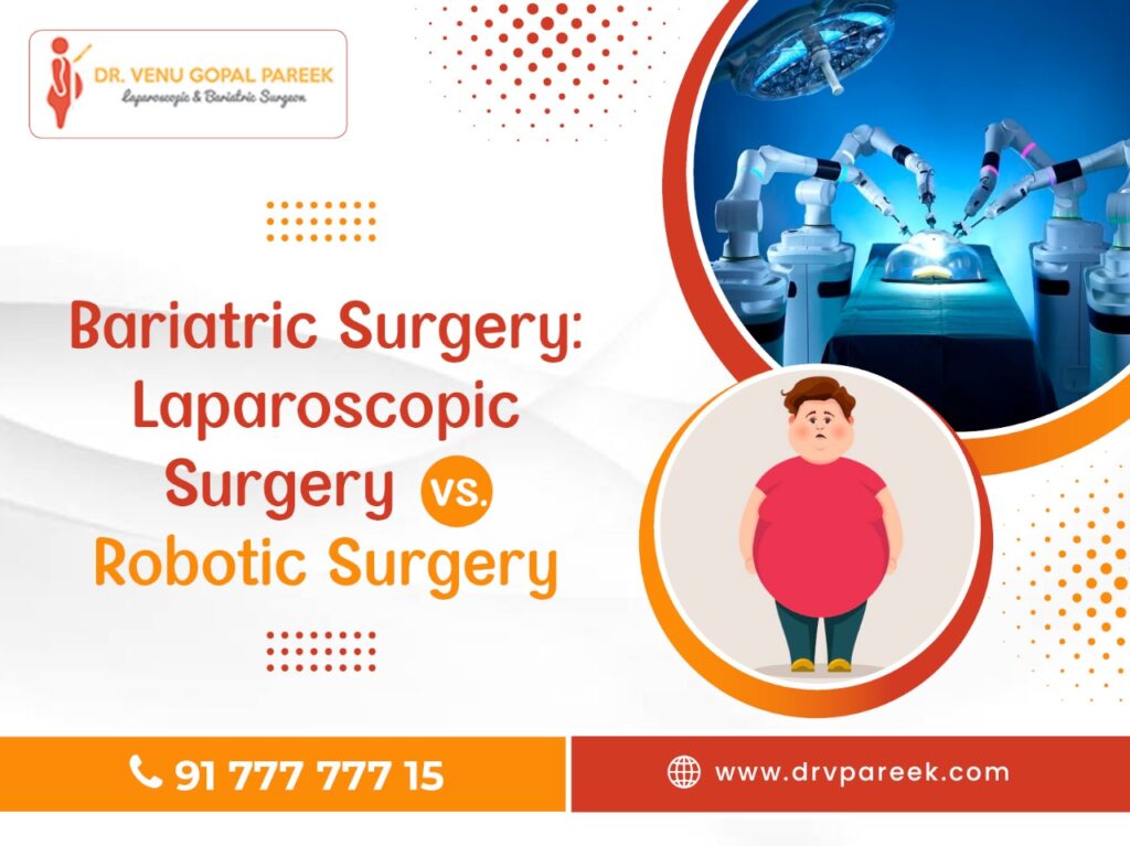 Bariatric Surgery: Laparoscopic Surgery vs. Robotic Surgery - Bariatric Surgeon India