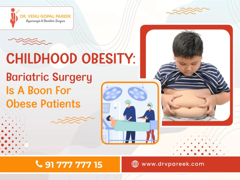 Childhood Obesity: Bariatric Surgery Is A Boon For Obese Patients ...