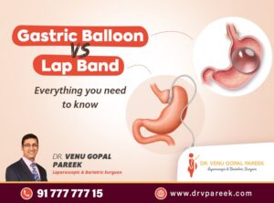 Gastric Balloon vs Lap Band - Bariatric Surgeon India