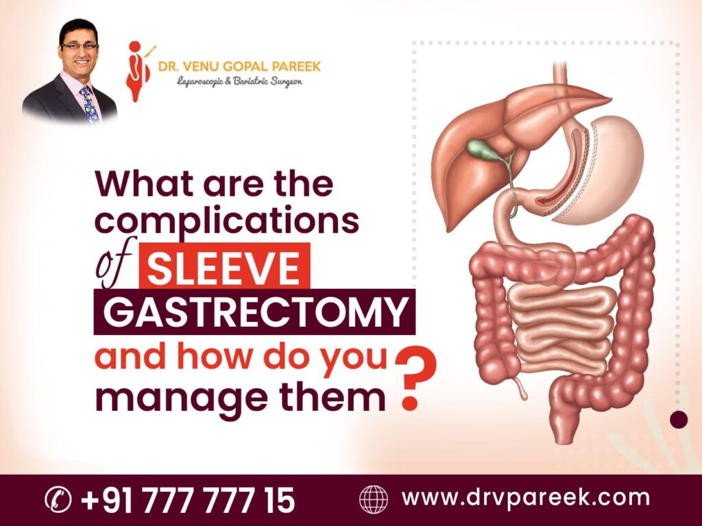 What are the complications of sleeve gastrectomy, and how do you manage ...