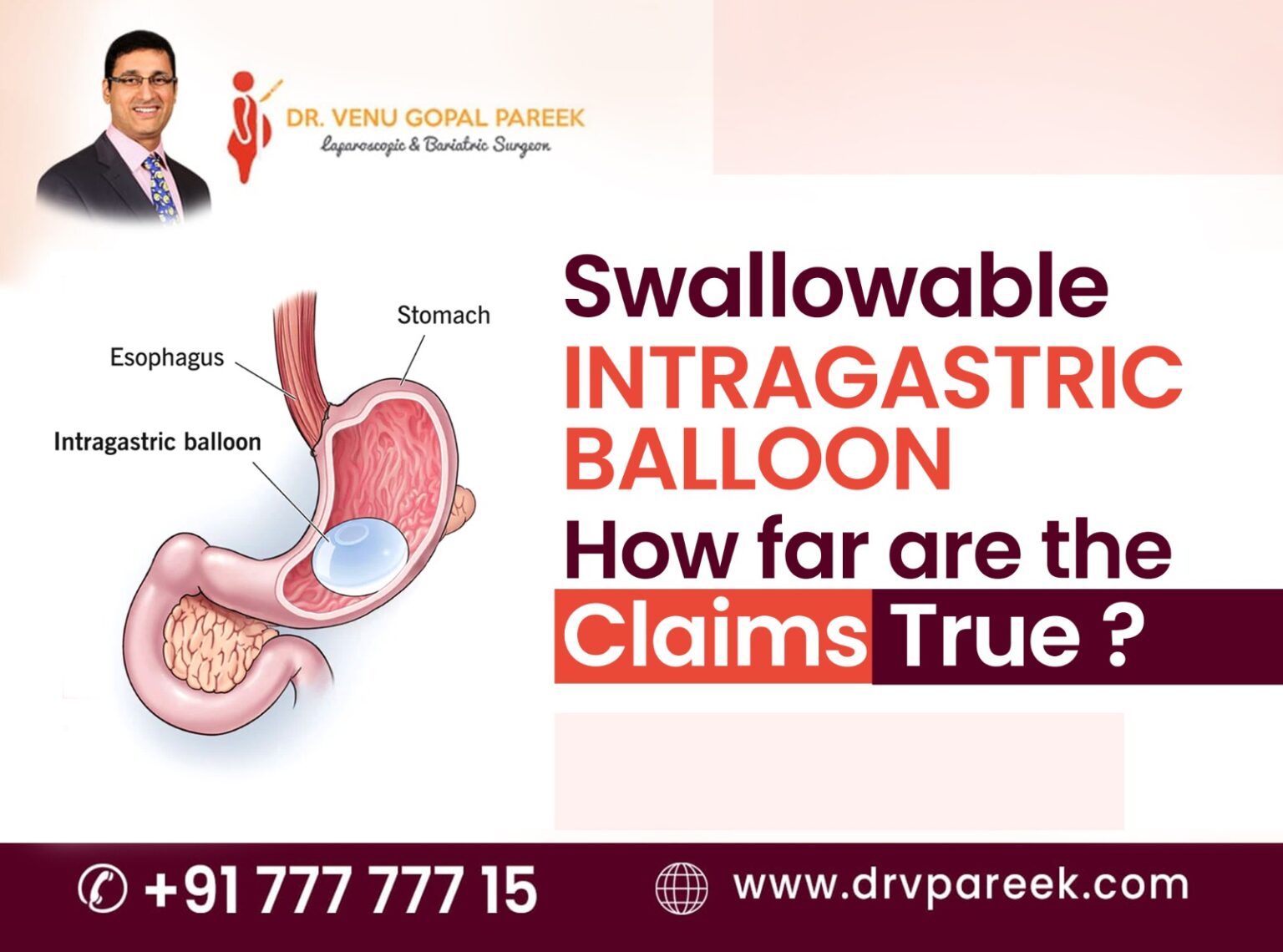 Swallowable intragastric balloons: How far are the claims true ...