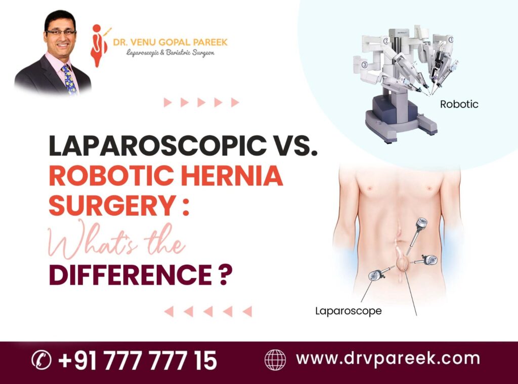 Laparoscopic vs. robotic hernia surgery: what’s the difference? - Bariatric Surgeon India