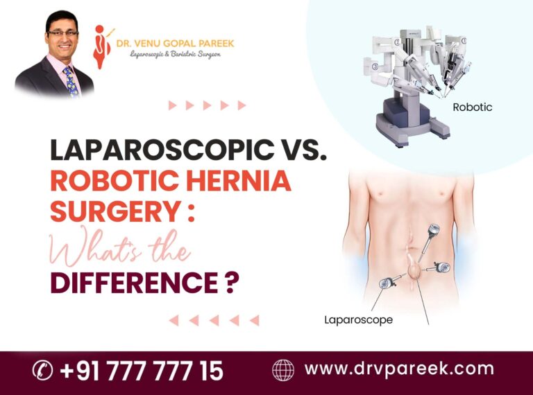 Laparoscopic vs. robotic hernia surgery: what’s the difference? - Bariatric Surgeon India